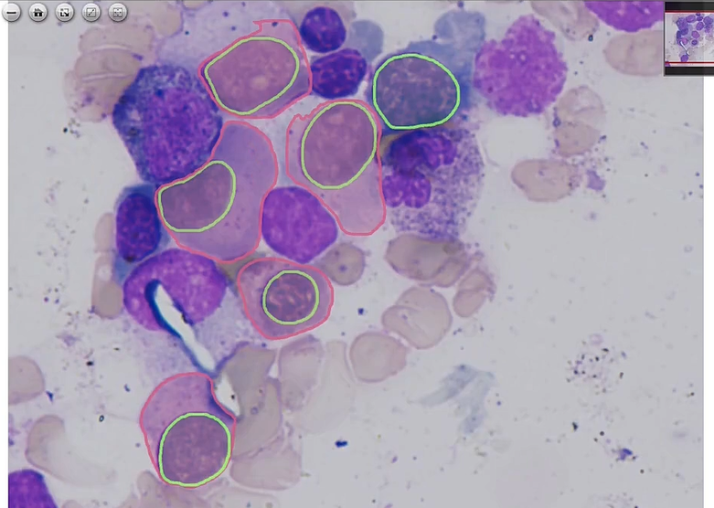 Cytoplasm Segmentation in High-Resolution Microscopy with Deep Block Cytoplasm Segmentation in High-Resolution Microscopy with Deep Block